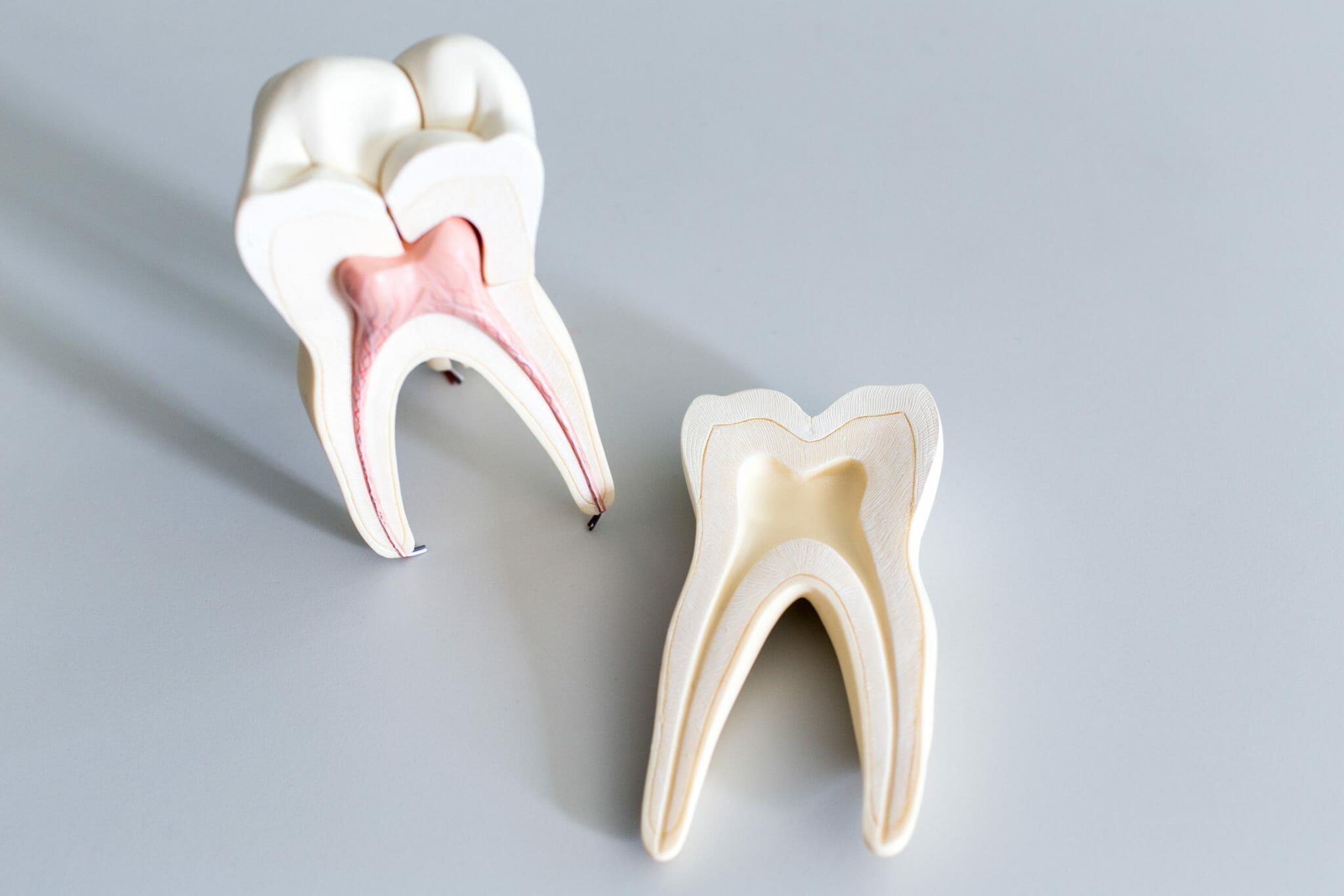 Pros and Cons of Root Canal Therapy - Angela Bateson, DDS